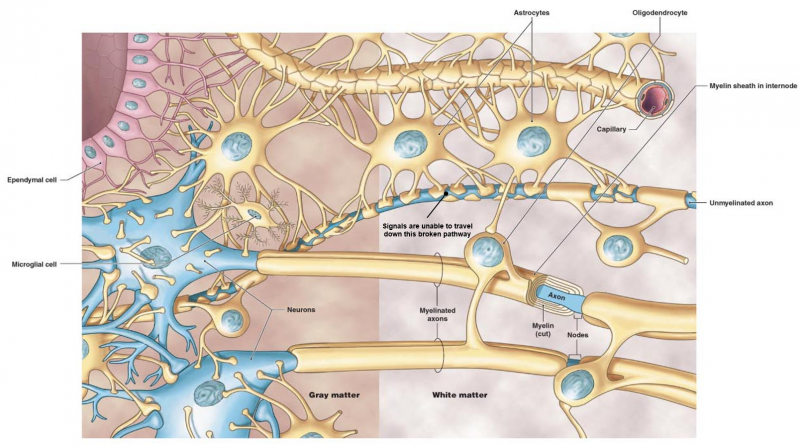 LEUKODYSTROPHY